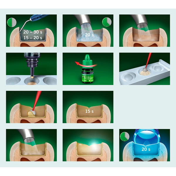 Dessensibilizante Gluma Desensitizer - Kulzer | Dental Cremer