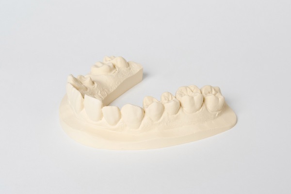 Gesso Pedra Especial Zero Stone Tipo IV Dentona