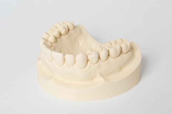 Gesso Pedra Especial Zero Stone Tipo IV Dentona